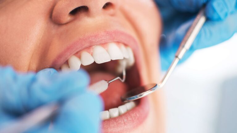 What Are the Different Types of Prophylaxis? - Dentist Hacketts Town